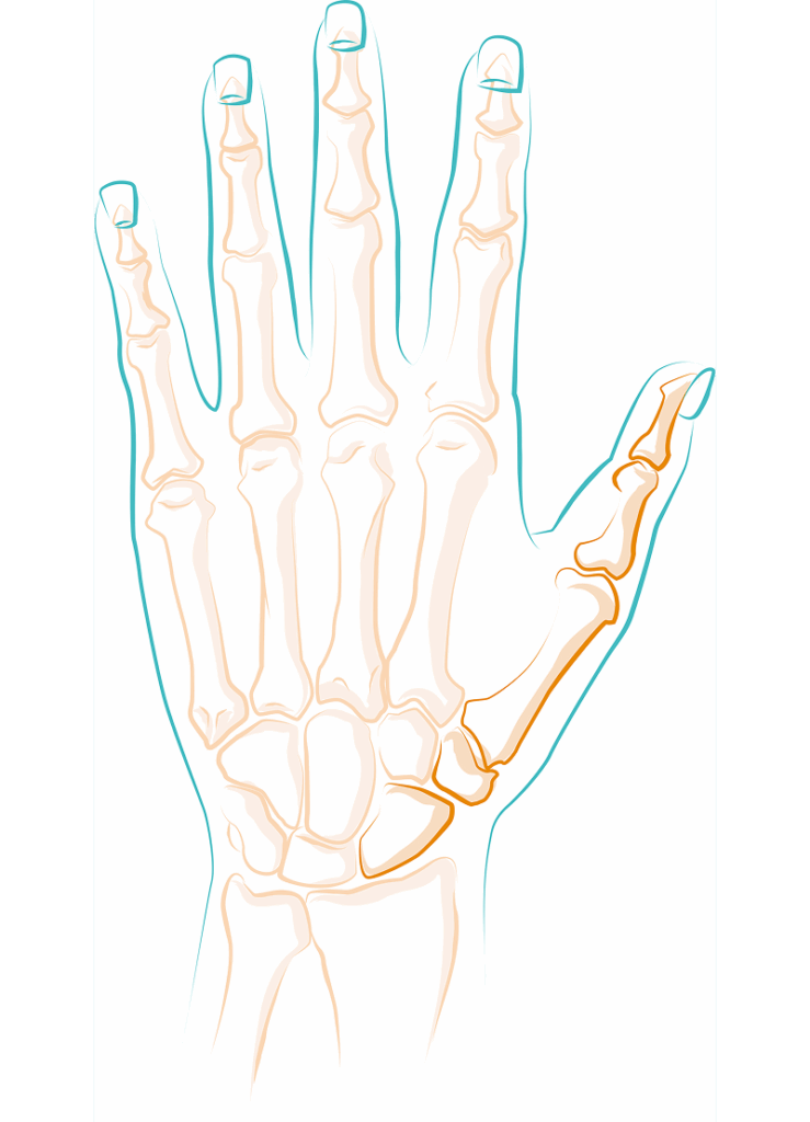 Anatomie des Daumens und Auswirkungen der Rhizarthrose - Mythumb DE